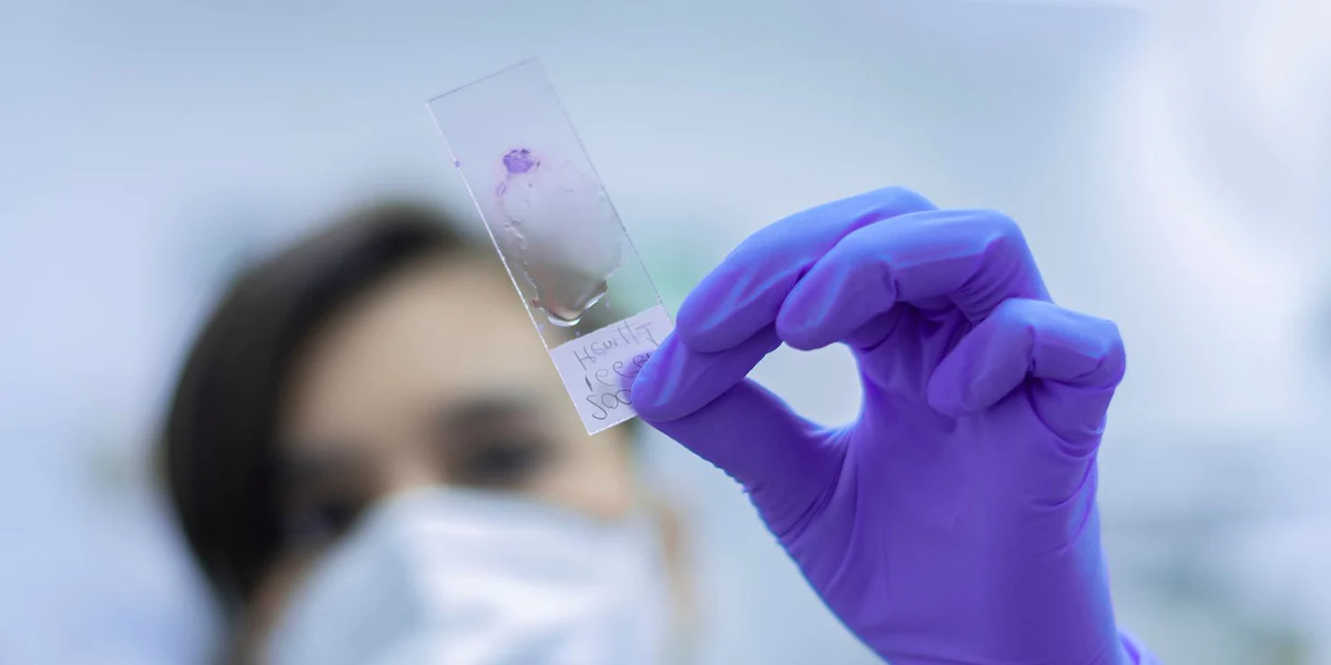 El calculadamente equívoco informe de la Agencia Española del ...